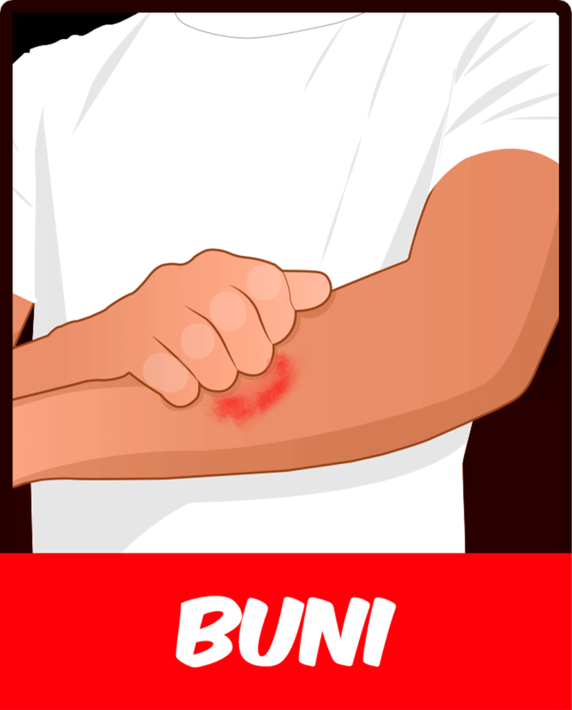 Fungisol - The trusted fungal infection medicine in the Philippines.